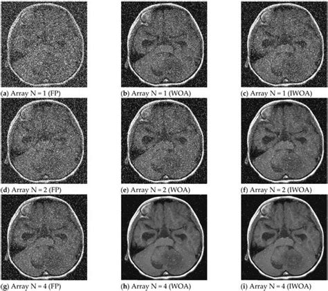 applied sciences free full text gray image denoising based on array stochastic resonance and
