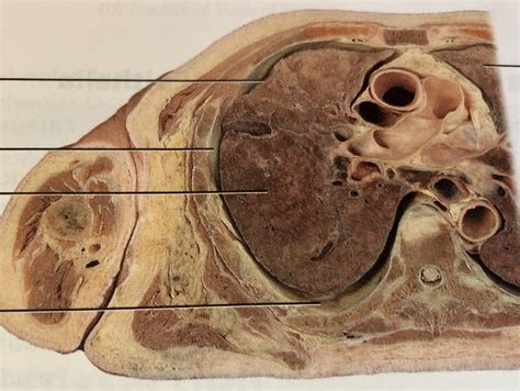 Pleura Transverse Section Through Thorax Inferior View Diagram