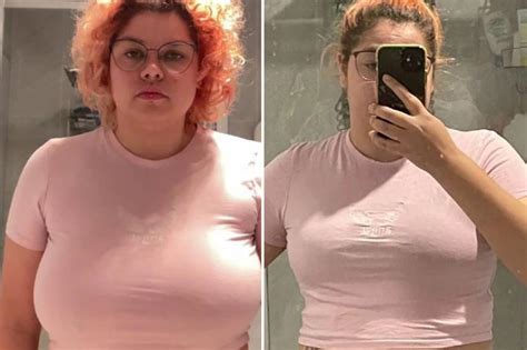 Influencer Melissa Mason 21 Hannah Gallop 20 Reveal Why They Got Breast Reduction Surgery
