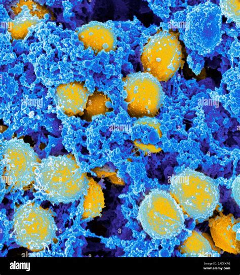 Staphylococcus Aureus Bacteria Coloured Scanning Electron Micrograph