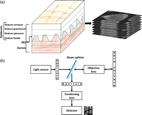 Automating Reflectance Confocal Microscopy Image Analysis For