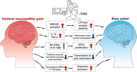 Non Invasive Brain Stimulation For Central Neuropathic Pain Cn Social