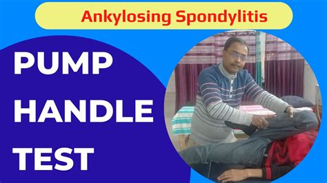Pump Handle Test Ankylosing Spondylitis How To Do Pump Handle Test