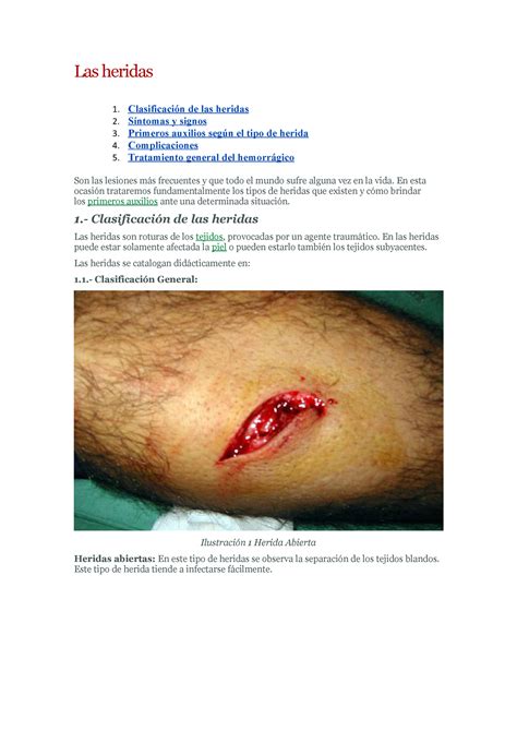 Las Heridas Una herida es una lesión física en el cuerpo que causa