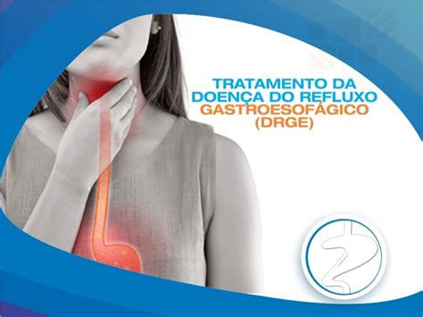 Otorrino Cuida De Refluxo BRAINCP