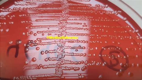 Escherichia Coli Introduction Pathogenic Strains And Preventive