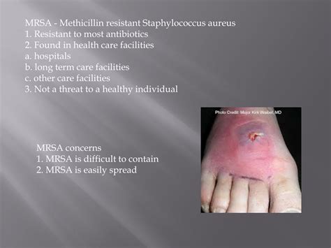 PPT MRSA Methicillin Resistant Staphylococcus Aureus PowerPoint