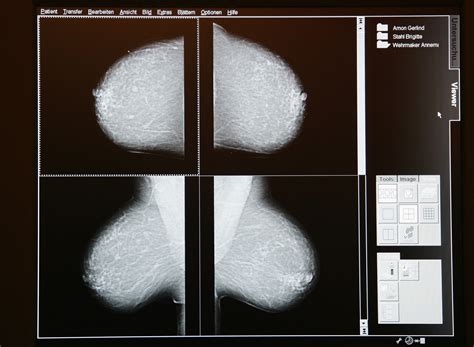 6 Surprising Things You Didn T Know About Your Breasts