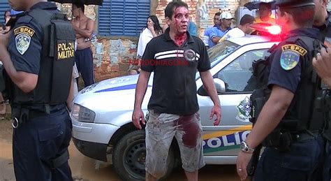 MULHER É BALEADA APÓS DUPLA TENTAR ASSALTAR PM Fotos Polícia