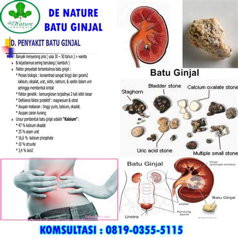 Cara Alami Mengeluarkan Batu Ginjal Pada Wanita Di Saluran Kencing