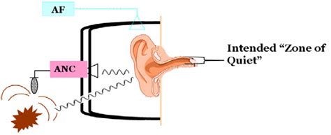 active noise control implementation and intended zone of quiet download scientific diagram