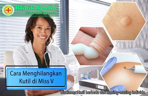 Cara Menghilangkan Kutil Di Miss V Pada Wanita Dengan Aman Klinik