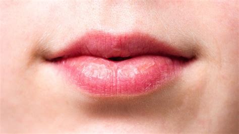 Labios Agrietados Principales Causas Y Como Prevenirlas