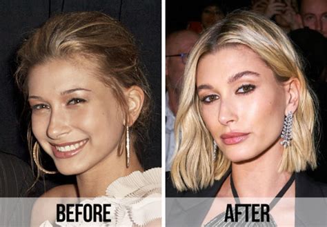 Top Tom Cruise Nose Job Update