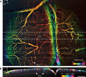Wide Field Of View Volumetric Imaging By A Mesoscopic Scanning Oblique
