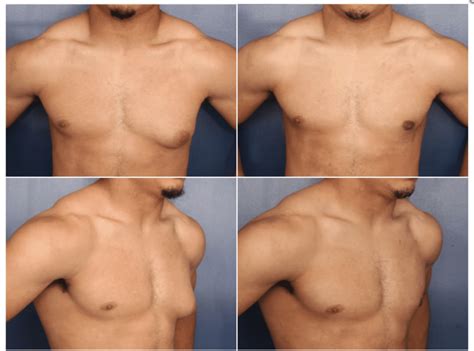 Beyond The Chest A Comprehensive Guide To The Multifaceted Benefits Of