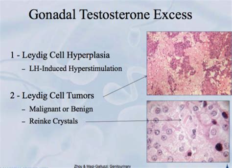 Lecture 2 Male Hormones HPG Axis And Puberty KH Flashcards Quizlet
