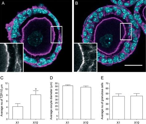 Transzonal Projections TZPs Are Significantly Increased In Follicles