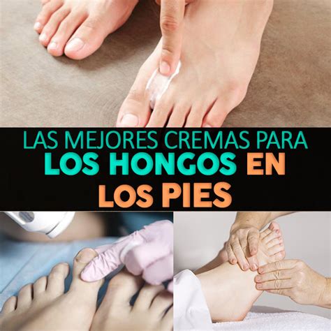 Las Mejores Cremas Para Los Hongos En Los Pies La Gu A De Las Vitaminas
