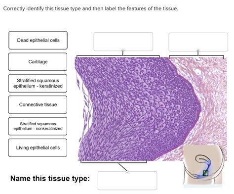 Solved Correctly Identify This Tissue Type And Then Label The Features