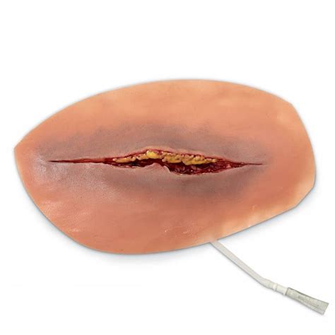 Moulage Wounds