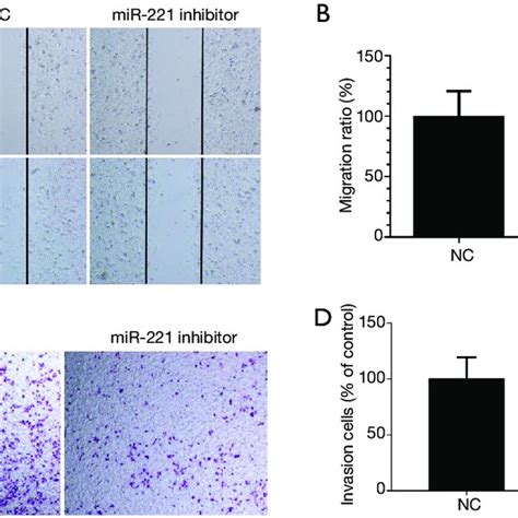 MiR 221 Promotes GBM Cell Migration And Invasion In Vitro A B Wound