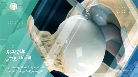 Hip Labral Reconstruction Youtube