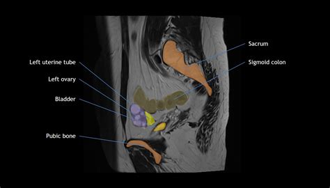 Pelvis Anatomy Module Casestacks