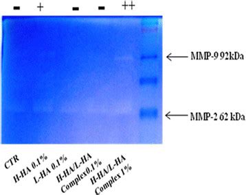 Gelatin Zymography Showing The Activity Of Kda Mmp And Kda