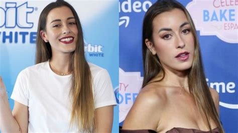 El antes y el después de Paula Gonu tras pasar por quirófano un cambio