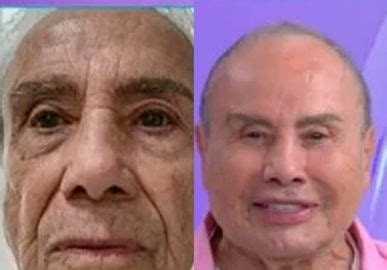 Aos 91 anos de idade Stênio Garcia faz harmonização facial e resultado
