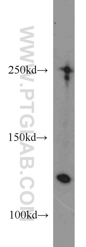 Collagen Type III N terminal antibody 22734 1 AP Proteintech 武汉