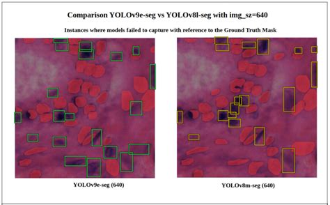 YOLOv9 Instance Segmentation On Medical Dataset