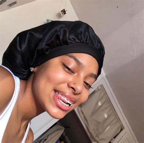 Pin On Braces
