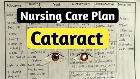 Nursing Care Plan On Cataract Nursing Diagnosis Nursing Process