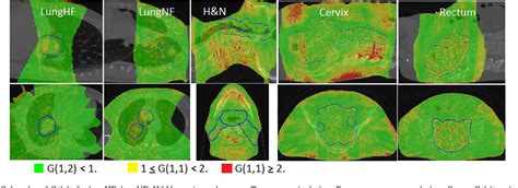 figure 2 from validation of the acuros xb dose calculation algorithm versus monte carlo for