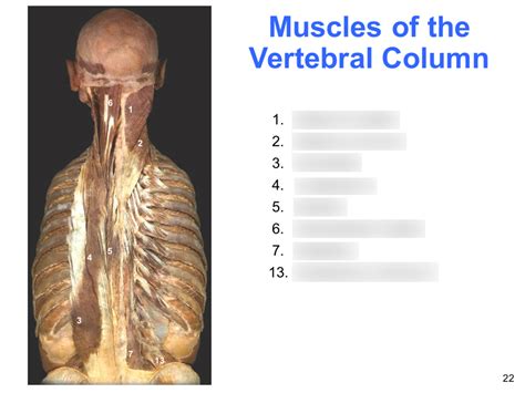Muscles Of The Vertebral Column Diagram Quizlet