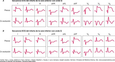 12 Derivaciones Del Electrocardiograma Pdf Coger Hora Para El Medico