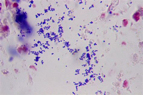 Bacterial Morphology Microbiology Learning The Why Ology Of