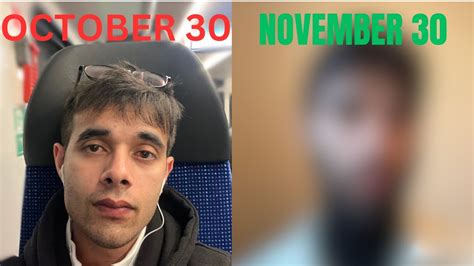 Days Beard Growth Time Lapse No Shave November Youtube