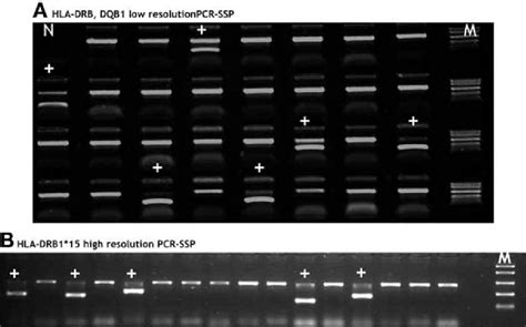 Pcr Using Sequence Specific Primers Pcr Ssp Results For Low And