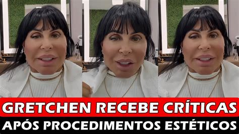 Gretchen surge irreconhecível após fazer novos procedimentos estéticos
