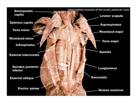 Erector Spinae Muscles Cadaver
