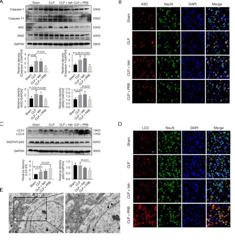 Figure 1 From The Pannexin 1 Channel Regulates Pyroptosis Through