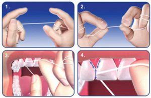 S Ntesis De Art Culos Como Usar El Hilo Dental Actualizado