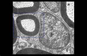 HLS Nervous Tissue And Neuromuscular Junction EM Myelinated Axon
