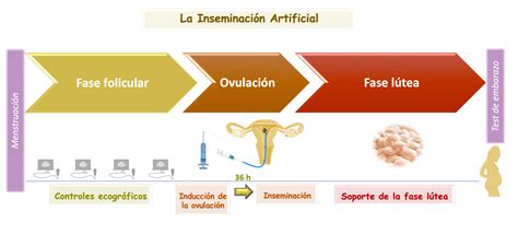 Inseminaci N Artificial Gyneco Fiv
