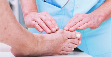 Bunion Symptoms Causes Natural Treatments Dr Axe
