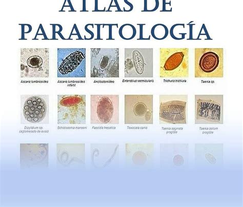 Infografia Parasitologia cccccccccccc La parasitología es una rama de