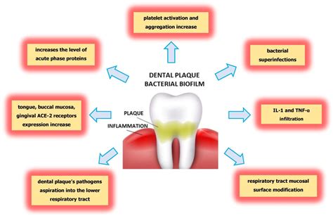 Dental Plaque Encyclopedia MDPI